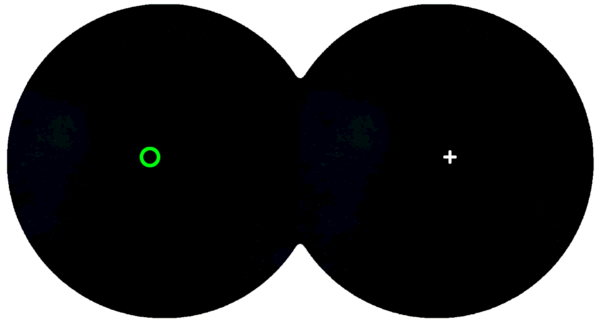 Optics Trainer VR - VR for Amblyopia, Strabismus, and CI