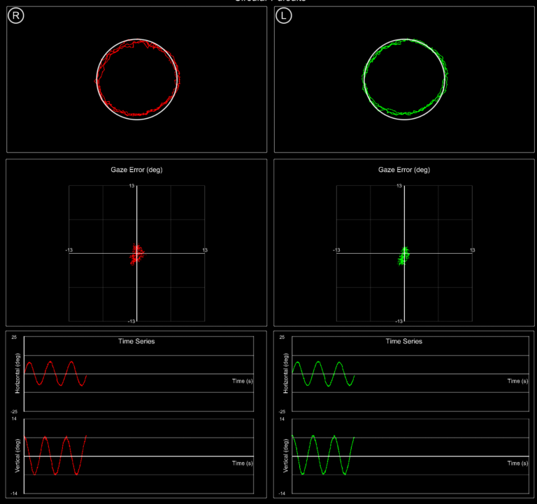 Optics Tracker - Vision Tracking