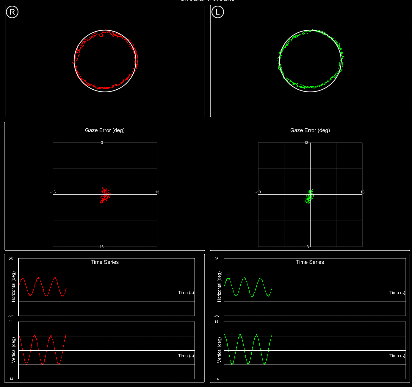 Optics Tracker - Vision Tracking